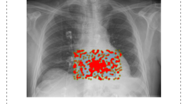Video: Using Hot Spot questions in exams - Speedwell