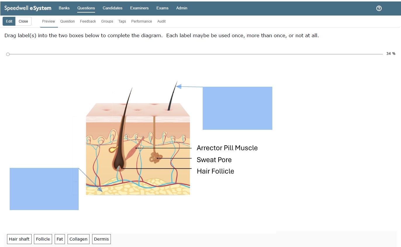 Enhancing Assessment Experience: The Role of Drag-and-Drop Questions ...
